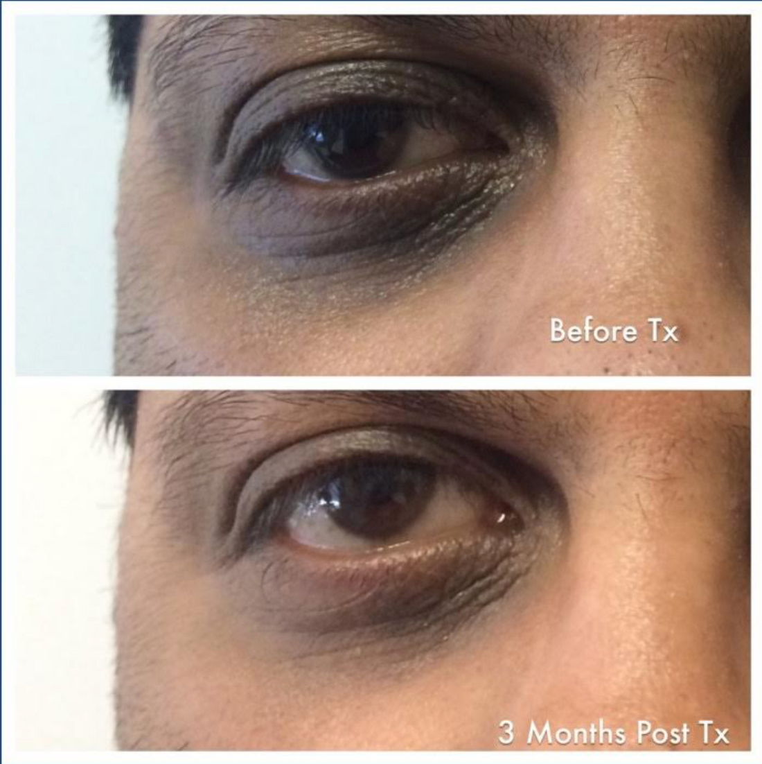 RX Repair Eye Cream – Accelerated Aesthetics